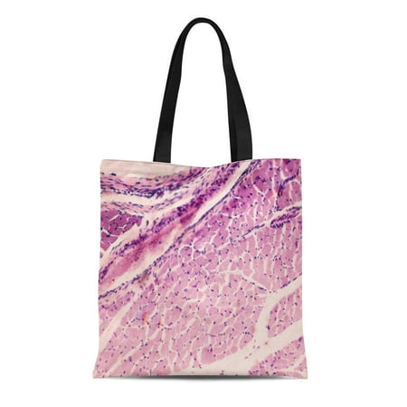 JSDART Canvas Tote Bag Red Cross Section of Muscle Skeletal Under the ...