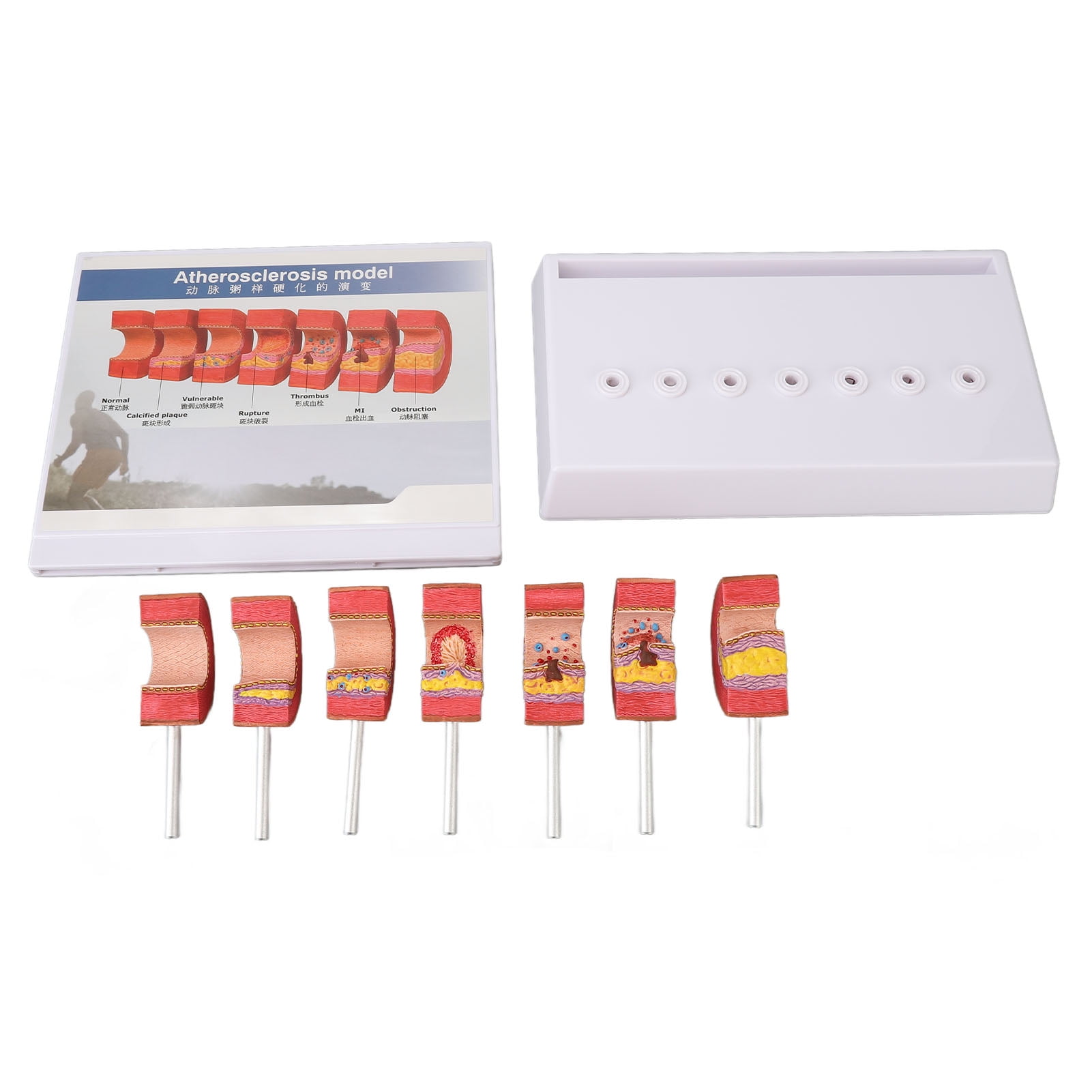 Human Body Artery Model, Beautiful Hand Paint Environmentally Friendly ...