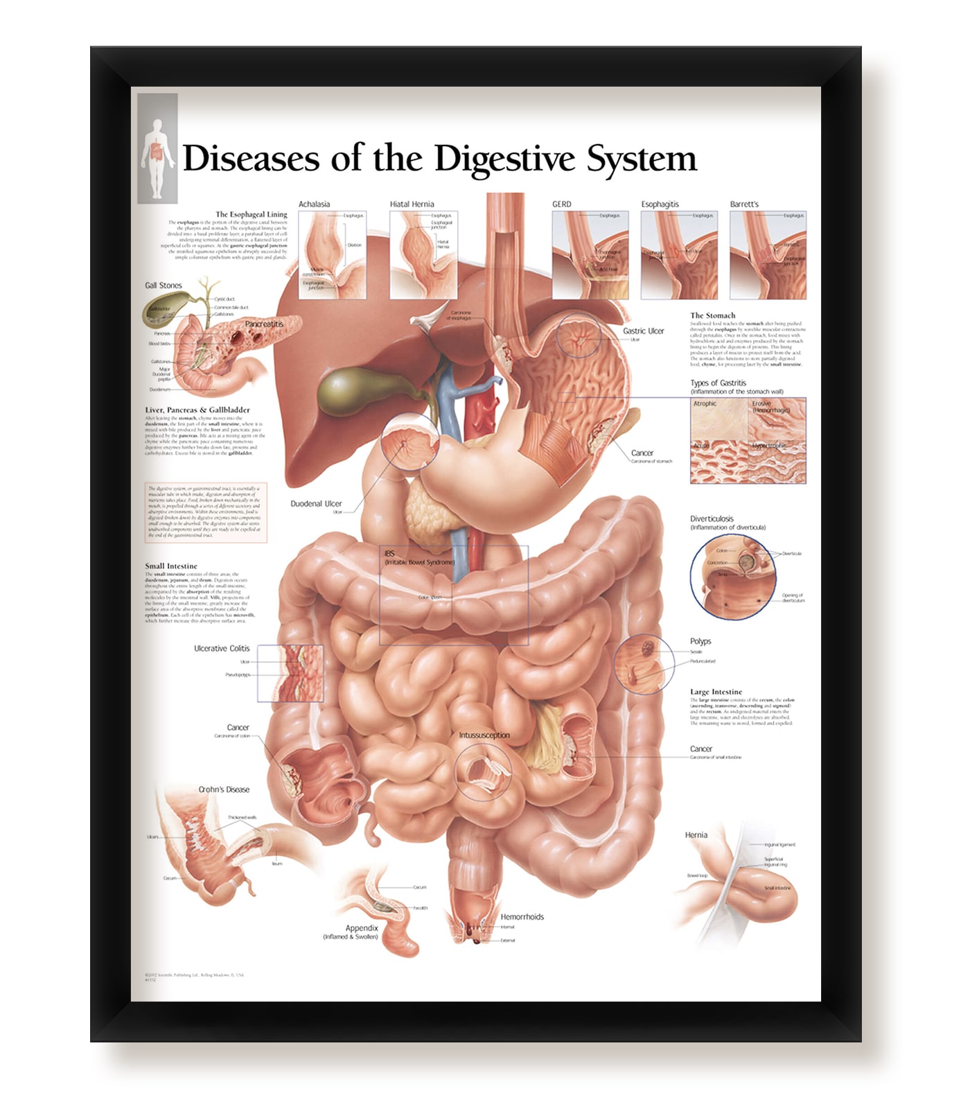 Digestive System Wall Chart with plastic edging for hanging Charts ...