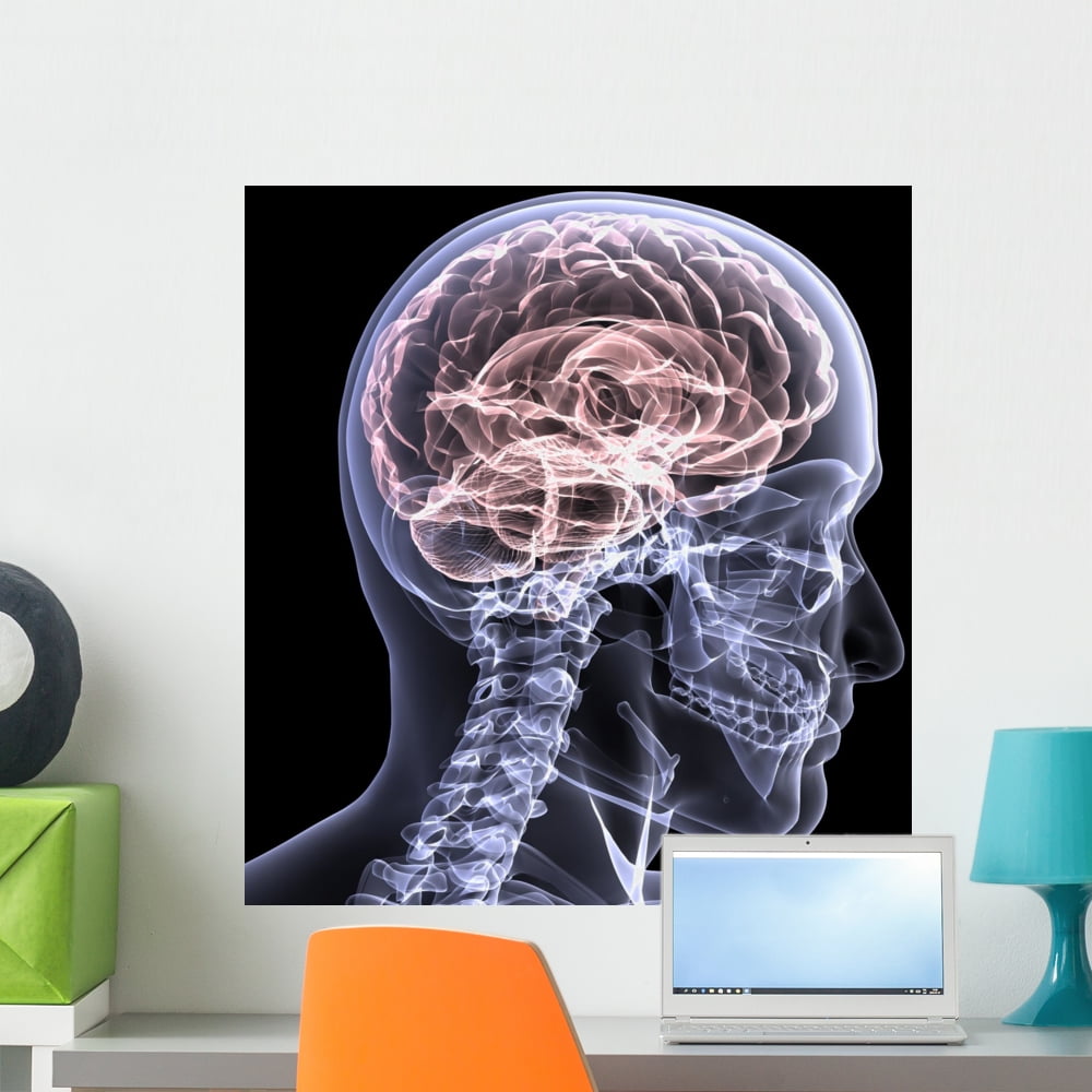 Skeleton X-ray Brain 1 Wall Mural by Wallmonkeys Peel and Stick Graphic ...