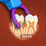 T.Smile Evolutionary Clean Dental Flossers, Kit of Refills Plus Long ...