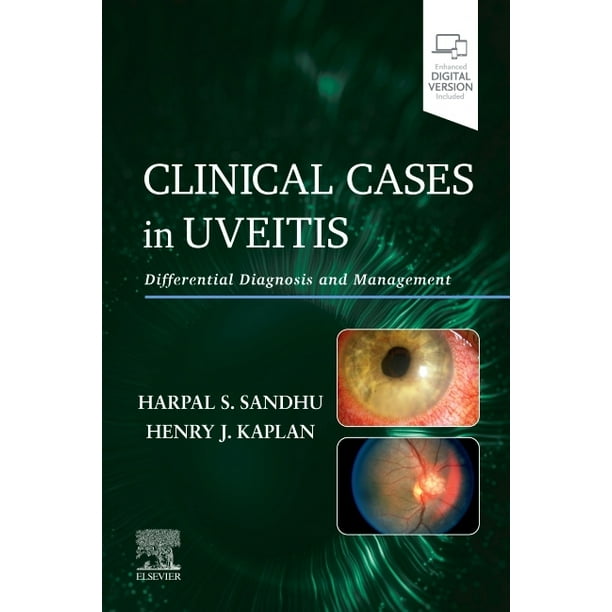 Clinical Cases In Uveitis Differential Diagnosis And Management Paperback