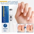 Nail Fungus Cleaning Laser Pen,Nail Fungus Cleaning Laser Device Nail ...