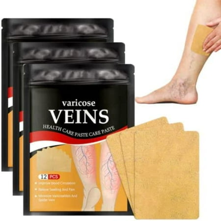 Varicose Veins Treatment Patch Spider Vein for Legs Edema Nerve Pain ...