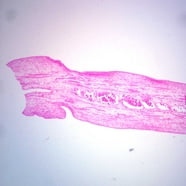 Human Smooth Muscle - Intestine, L.S. 7 M H&E Microscope Slide ...
