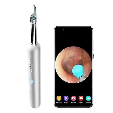 Ear Wax Cleaner Ear Picker Smart Ear Stick Wireless Ear Wax Removal ...