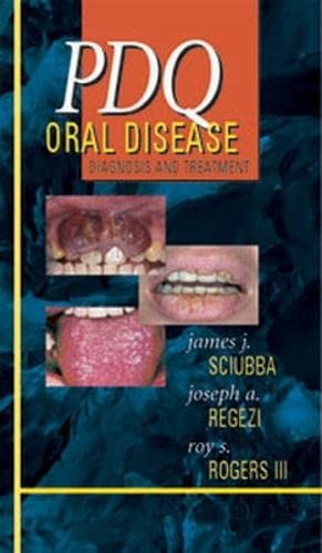 Pre-Owned PDQ Oral Disease : Diagnosis and Treatment - Walmart.com