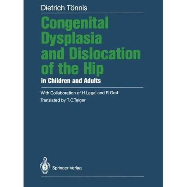 Congenital Dysplasia and Dislocation of the Hip in Children and Adults ...