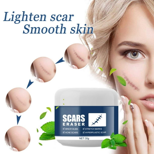 Archer 30g Scar Remove Cream Not Irritating Repair Damage Synthetic ...