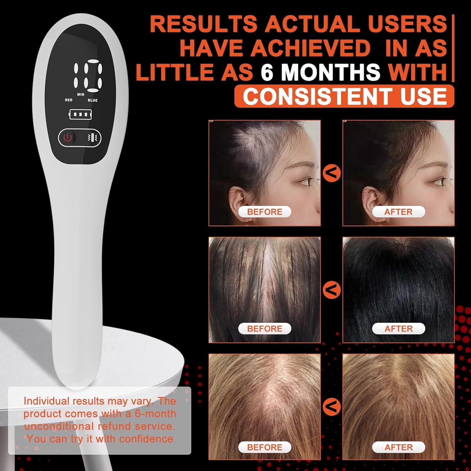 Click here for Ikeener Laser Hair Growth Comb (Fda Cleared)  Prof... prices