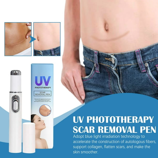 Scar Scar Portable Skin Tightening Inflammation Reducing Portable Scar ...