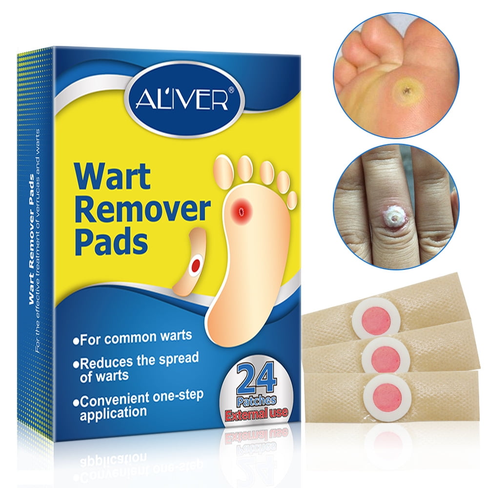 Parches ALIVER para Callos y Durezas en los Pies, Tratamiento Eficaz y ...