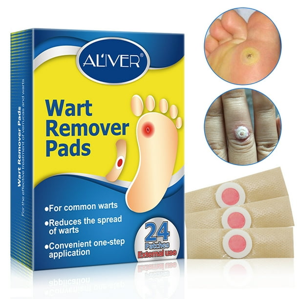 Parches ALIVER para Callos y Durezas en los Pies, Tratamiento Eficaz y ...