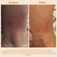 Thena 25 In 1 Healing Moisturizing Cream Dry Irritated Itchy Skin Care For Eczema Psoriasis 45