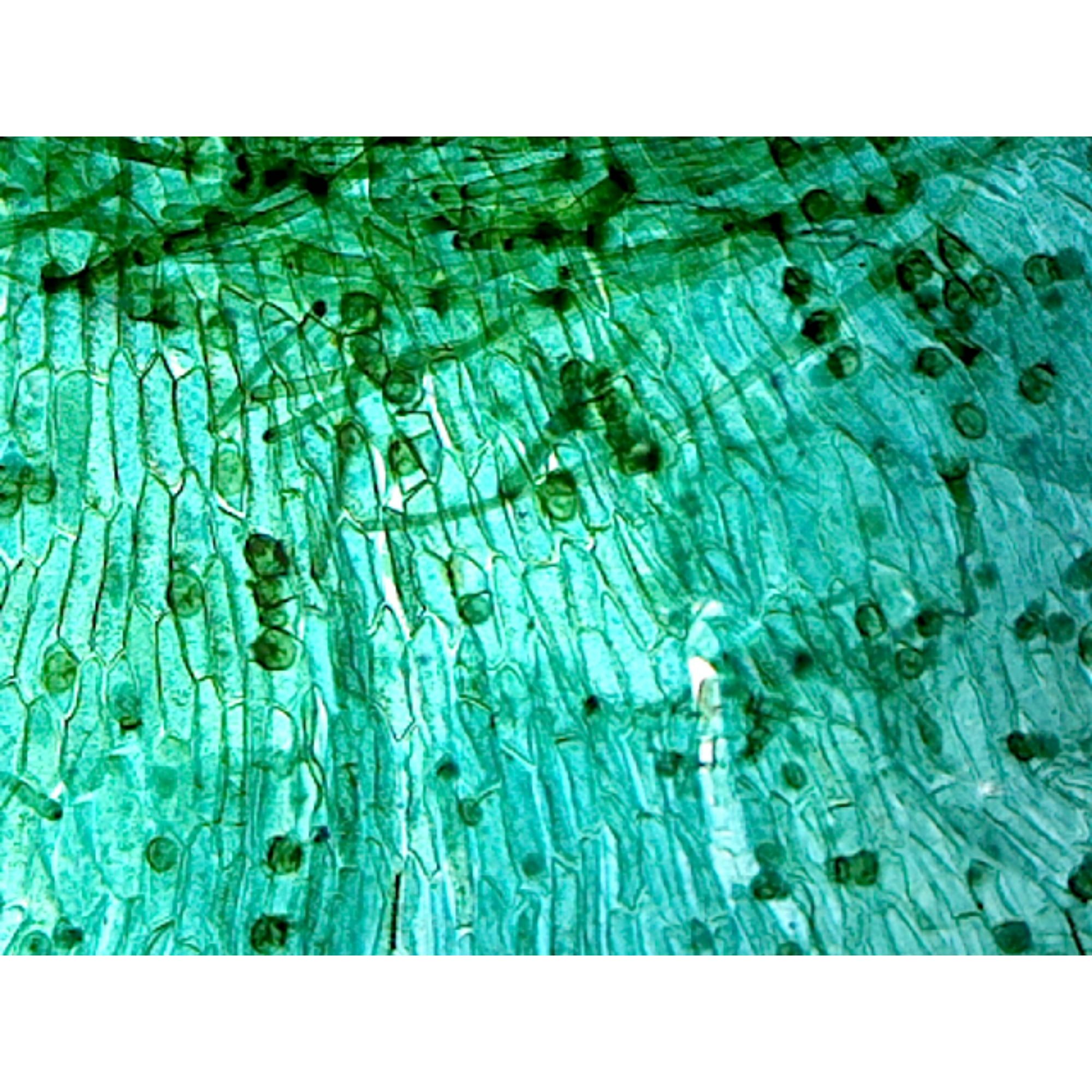 Fern Prothallium Filamentous