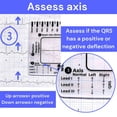Electrocardiogram 7 Step Ruler Card Tool Suitable For Use By ...