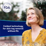 Compound W Nitrofreeze Skin Tag Remover, FDA Approved with 1 Skin Tag ...