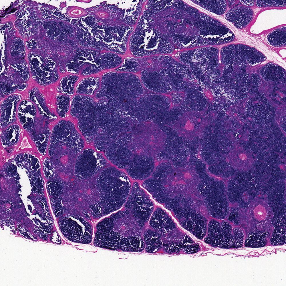 Thymus Slide