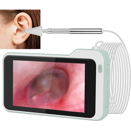 3.9mm Ear Inspection Camera with 5 inch IPS Screen Digital Otoscope ...