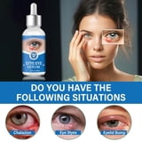 Stye Eye Treatment (30 ml) - Walmart.com