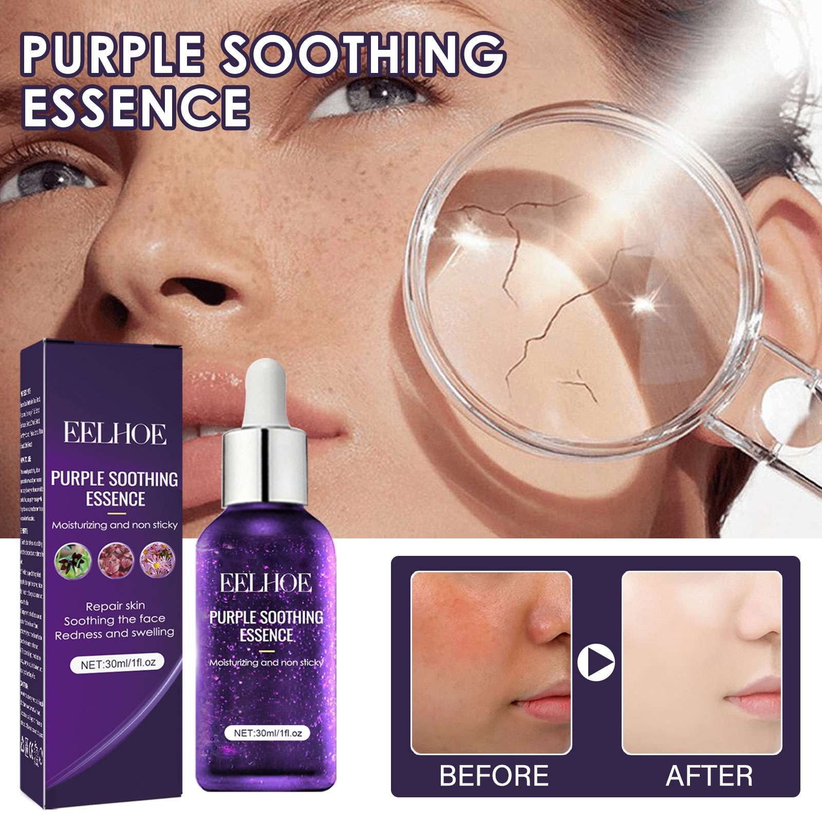 Fiudx Suero Calmante Morado, Cápsula Hidratante Multilipídica, Elixir Hidratante de Orquídea de ...