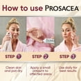 Prosacea Gel for Rosacea Redness, Pimples, and Irritation, Sulphur 1x ...