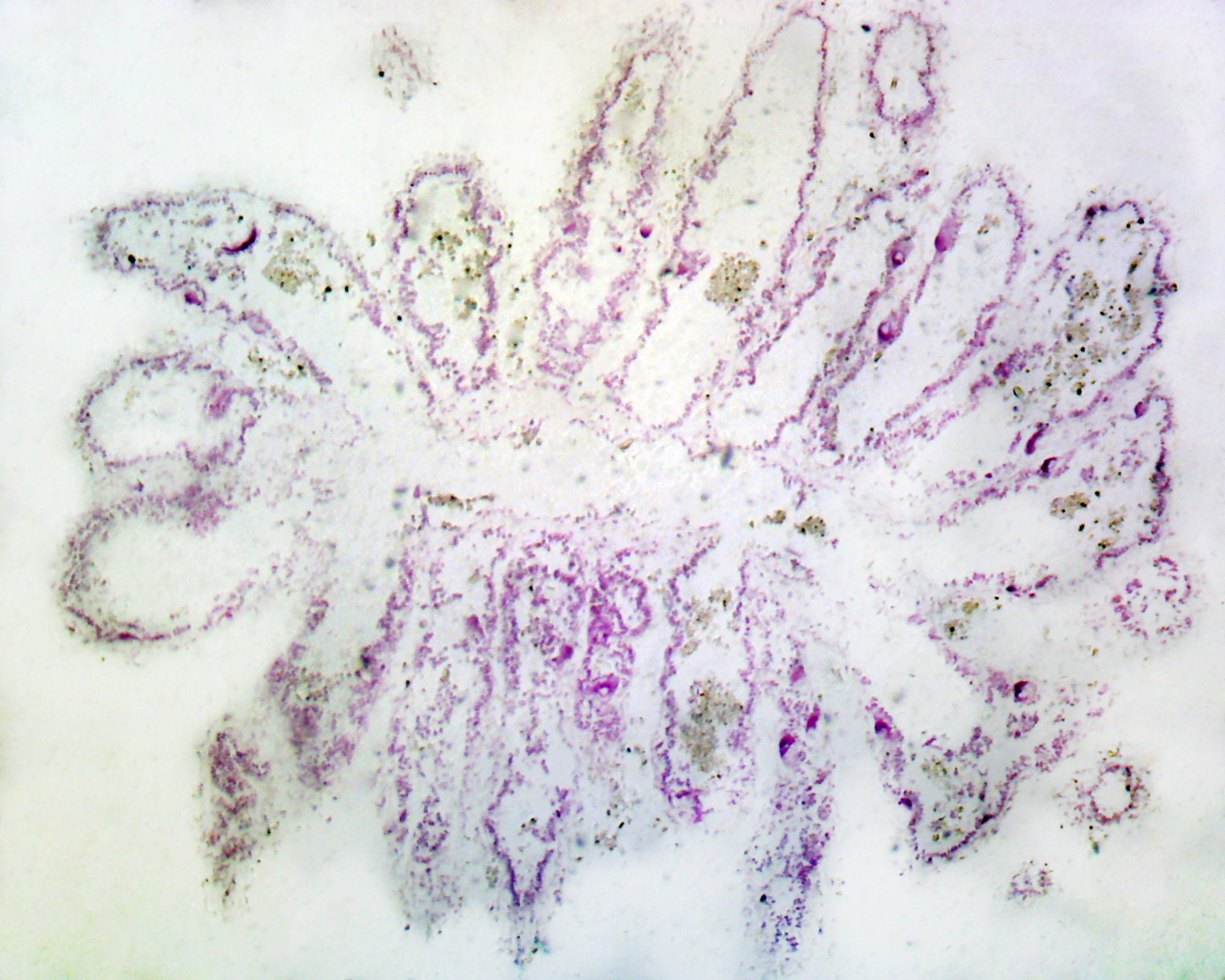 GSC International Grantia (Scypha) Cross Section H&E Stain - Microscope ...