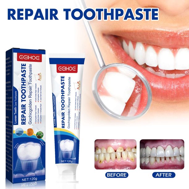 YiFudd Repair Toothpaste, Loose Tooth Care Toothpaste, Gingival Care ...