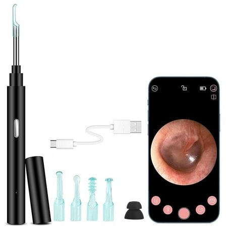 Earwax Remover Tool Kit Ear Cleaner Otoscope Wireless Ear Scope 1080P ...