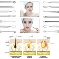 Tutuviw 7 in 1 Pimple Blackhead Remover Extractor Tool Kit Professional ...