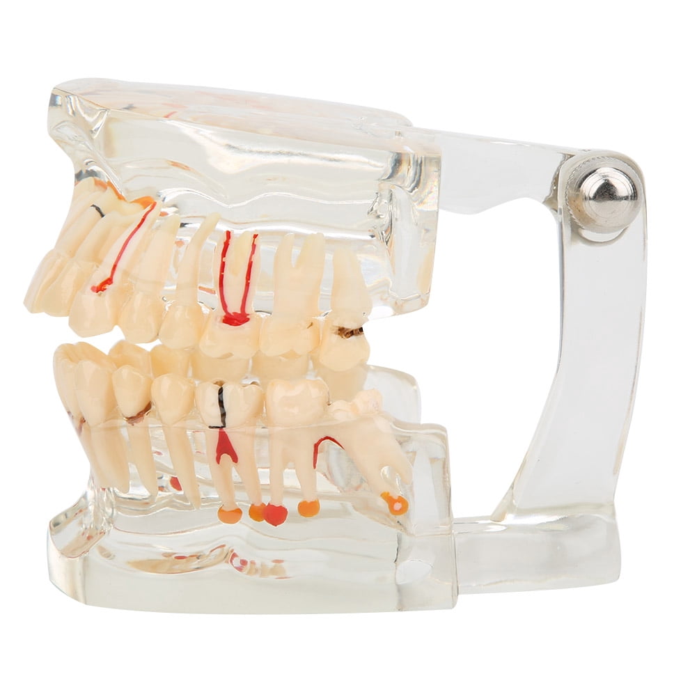 Modelos de dientes dentales, modelo de dientes transparentes para ...