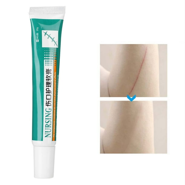 Amonsee Skin Wound Care Ointment,Wound Repair Ointment,Moisturizing Wound Care Ointment Scar ...