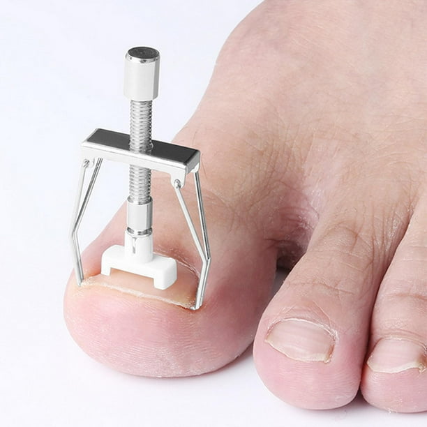 Herramientas de pedicura Juego de herramientas para uñas encarnadas ...