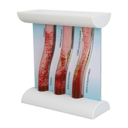 Lipoprotein LDL Blood Vessel Model, PP HIPS Lipoprotein Blood Vessel ...