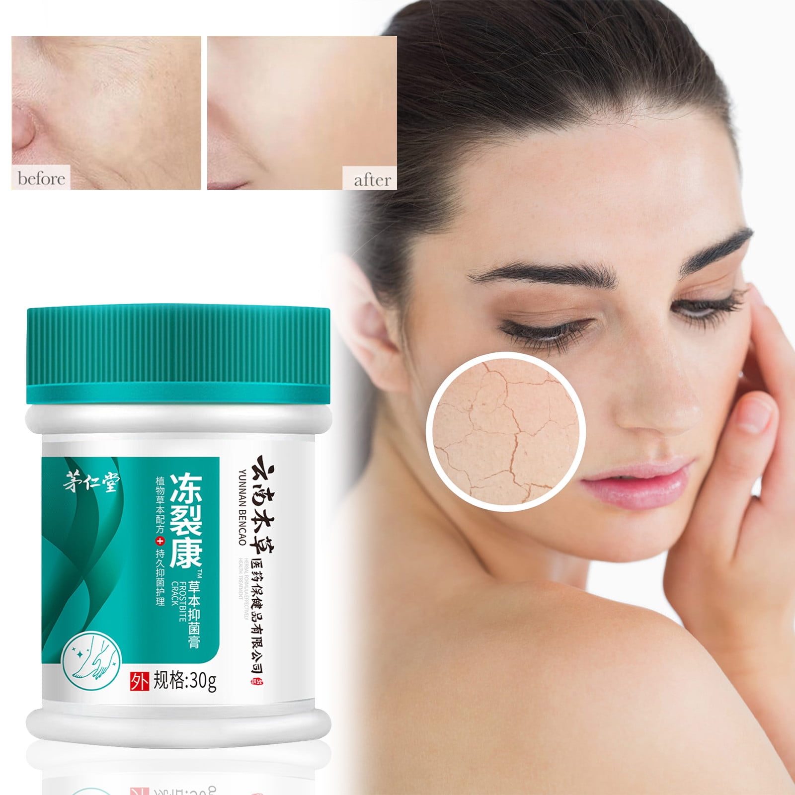 Crema Hidratante Ganfancp Yunnan Bencao Escarcha Salud 20G Aceite de ...