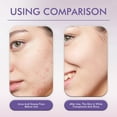 Pimple Patches,Stickers Reduce Patches Nose Reduce Pores Chin Cheeks ...