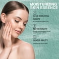 Cystic Hormonal And Severe Acne Treatment Cream For Teens And Adults