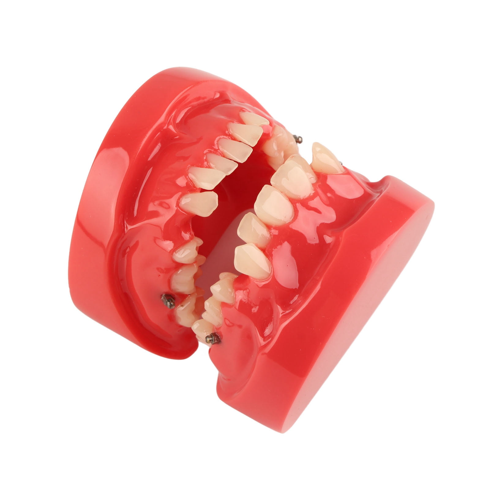Modelo De Demostración Dental, Modelo De Dientes De Ortodoncia Dental ...