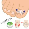 Toenail Corrector,And Nail De D'orteil Toenail Nail Toenail And Toenail ...