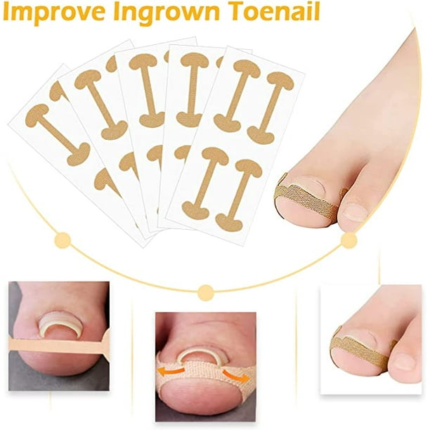 10 Pieces Woman Man Unisex Feet Health Care Adjuster Ingrown Toenail ...