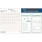 EMAY Portable ECG Monitor (for iPhone & Android, Mac & Windows ...