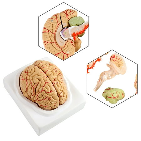 Brain Arteries Model, Hands On Experience Different Vivid Colors Life ...