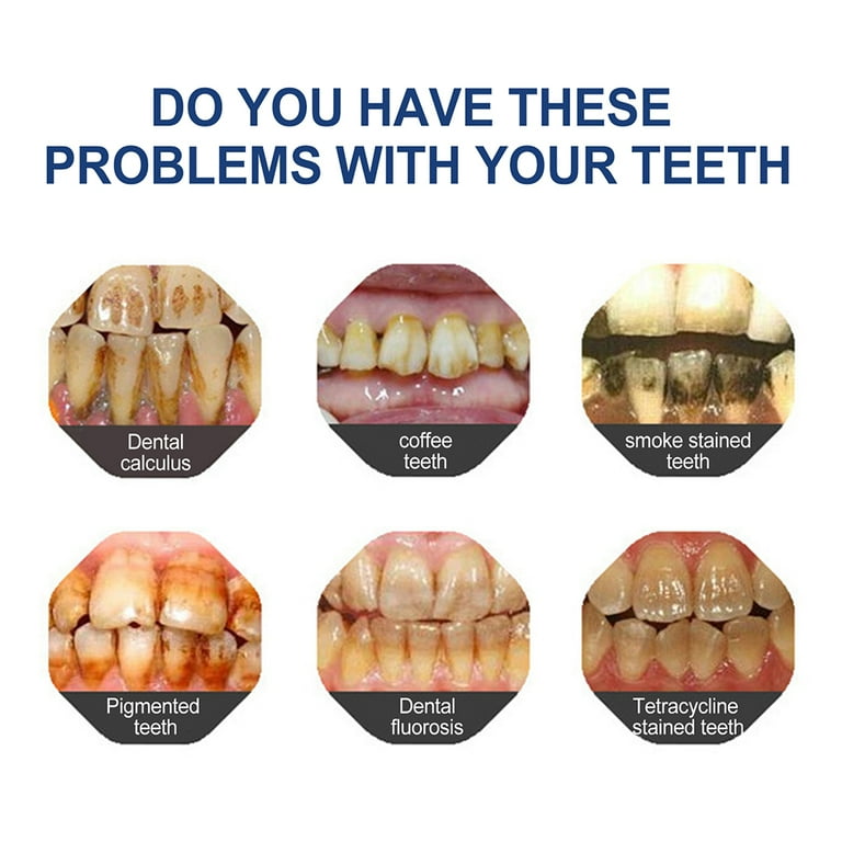 Cosmetic Teeth Paint