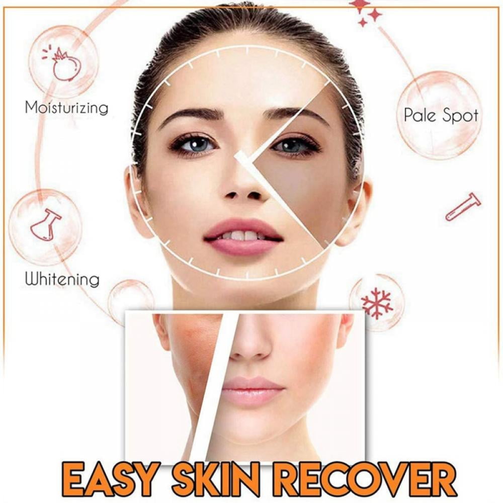 Buy Freckle Remover Cream, for Face Melasma Treatment Fade Cream -with ...