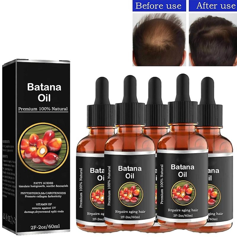 Click here for Jfbujc Natural Pure Batana Oil For Hair Growth Bat... prices