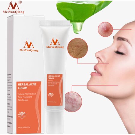 Mei Yan Qiong Herbal Purifying Acne Cream Inside fire containment ...