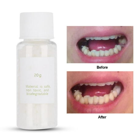Temporary Tooth Filling Material Temp Temp Repair Teeth Replace Missing ...