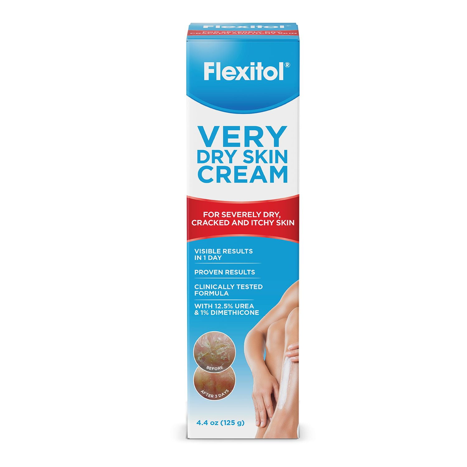 Flexitol Very Dry Skin Cream, Rich Moisturizing Body Cream with Urea, 4 ...