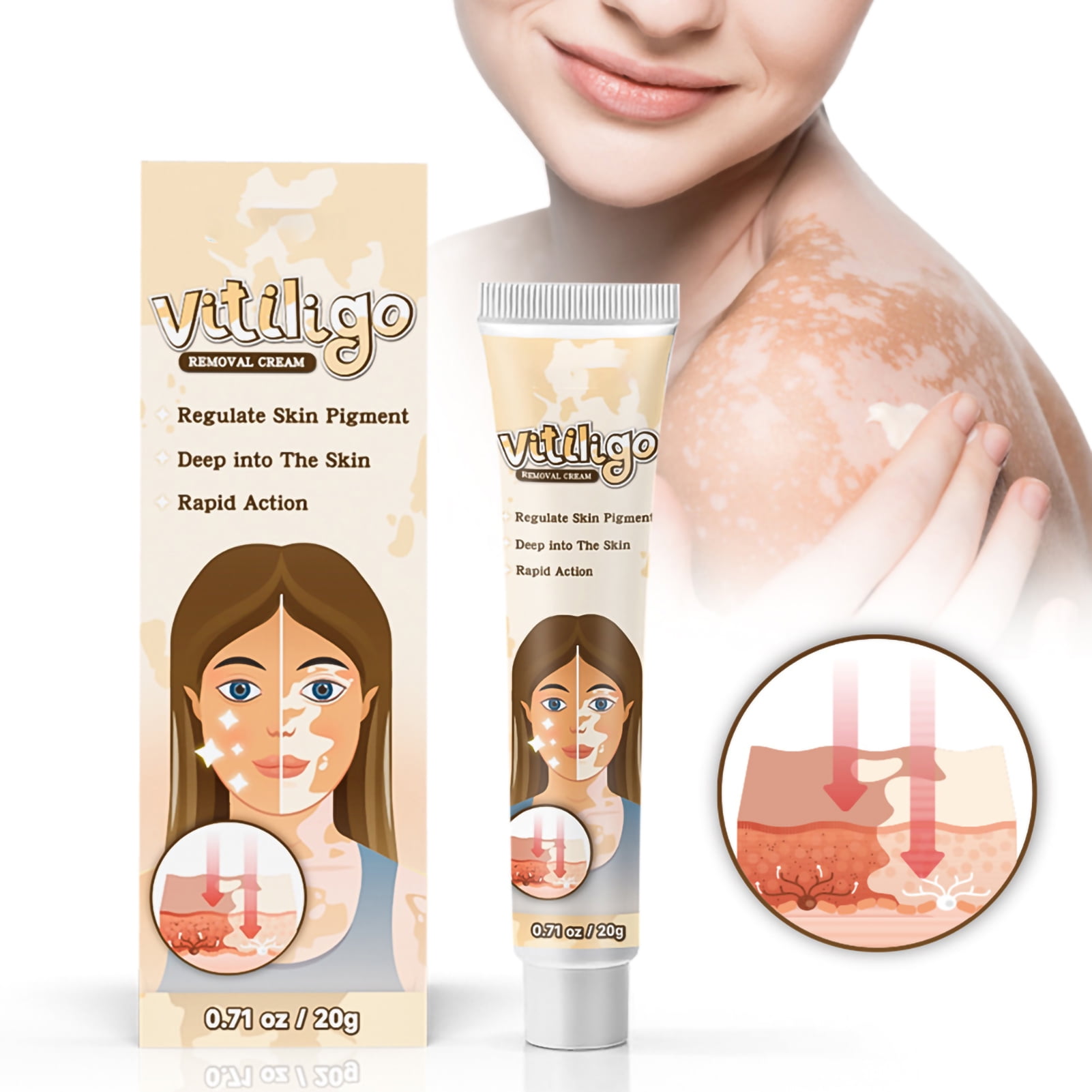 Crema para manchas blancas 20 g Ungüento para vitíligo Crema a base de ...