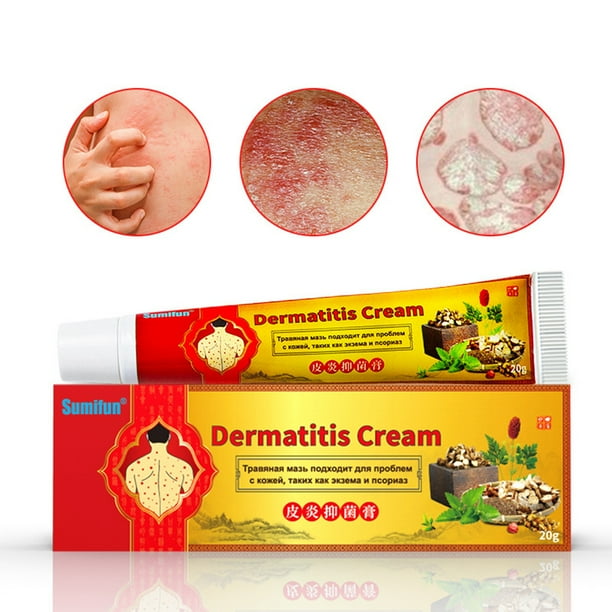 Piel Psoriasis Crema Dermatitis Eczematoid Eczema Ungüento Crema para ...
